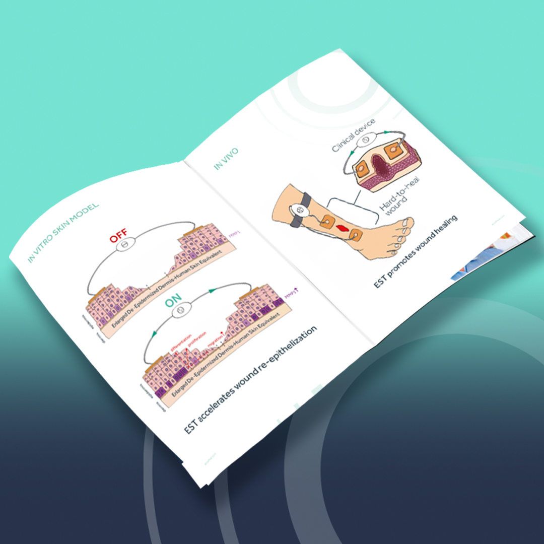 Revealing the positive effect of Accel-Heal on wound healing: insights ...