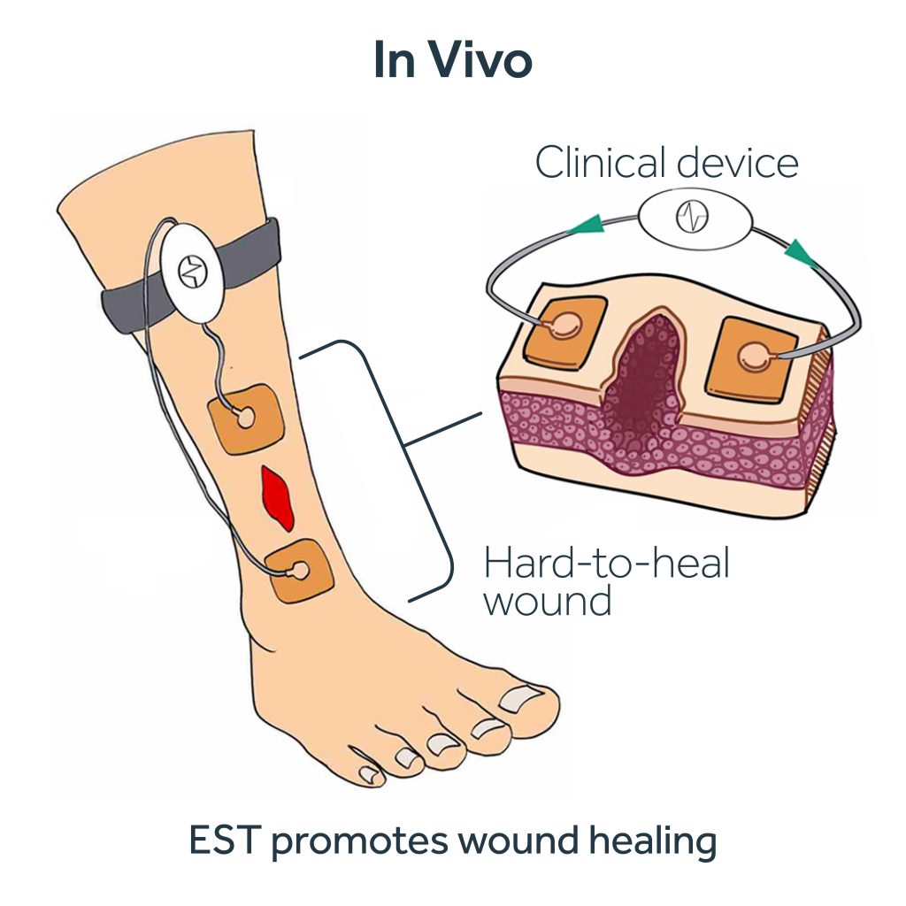 Revealing the positive effect of Accel-Heal on wound healing: insights ...