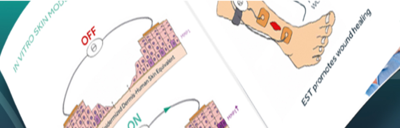 Accel-Heal | Electrical Stimulation Therapy for Chronic Wounds